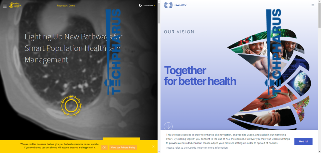 Zebra Medical Vision acquired by Nanox Imaging